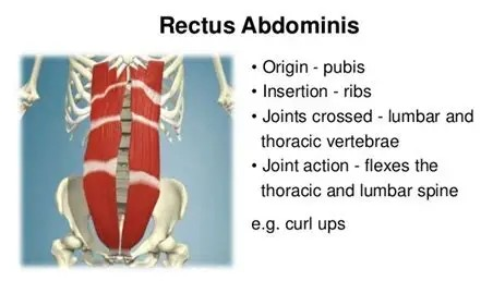 7339 - Hernia, ventral, postoperative | Medical EPSS