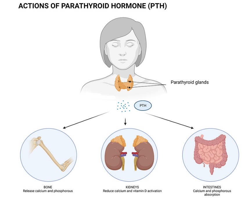 7905 - Hypoparathyroidism | Medical EPSS