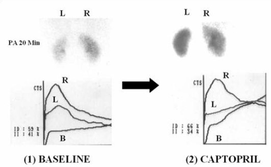 7534 - Atherosclerotic renal disease (renal artery stenosis or atheroemboli