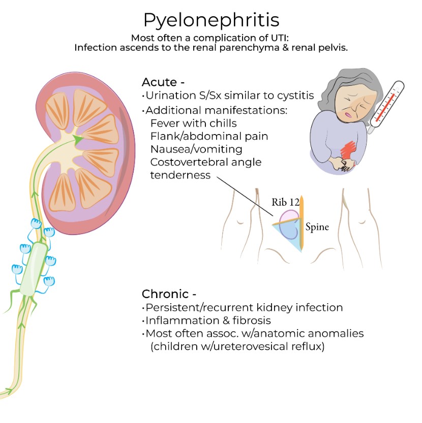 7504 - Pyelonephritis, chronic | Medical EPSS