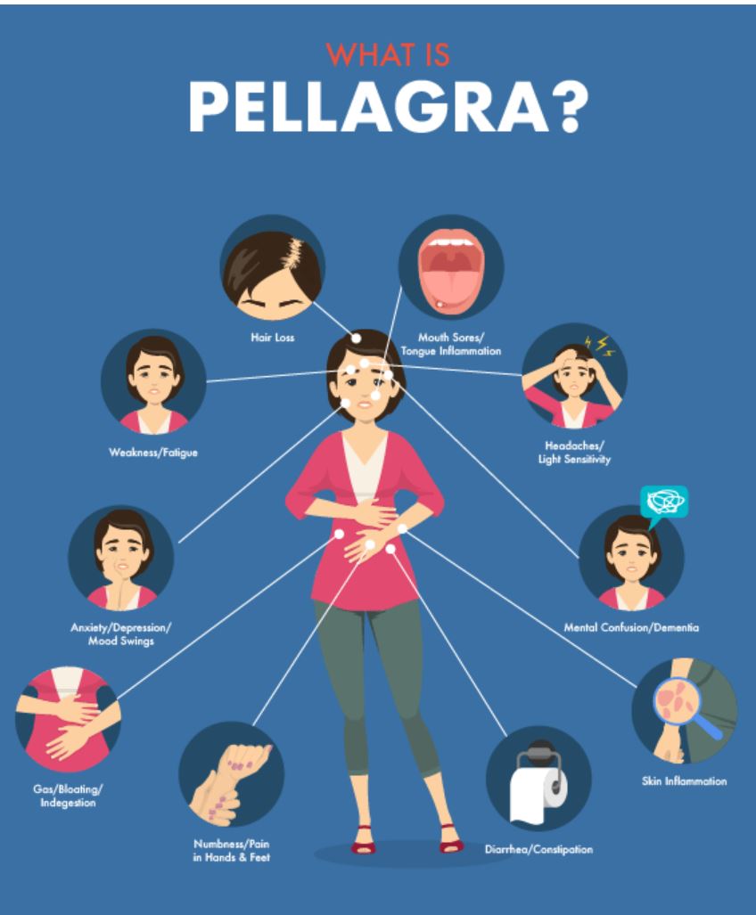 6315 - Pellagra | MEPSS | Medical EPSS