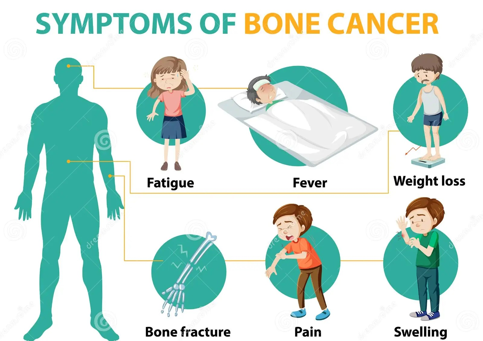 5012 - Bones, neoplasm, malignant, primary or secondary | MEPSS | Medical E