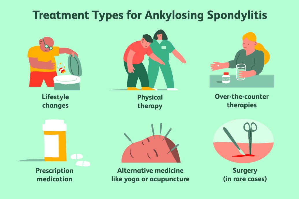 5240 - Ankylosing spondylitis | MEPSS | Medical EPSS