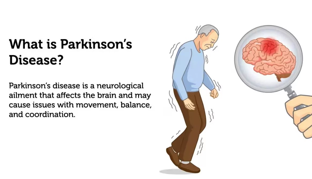 8004 - Paralysis agitans | Medical EPSS