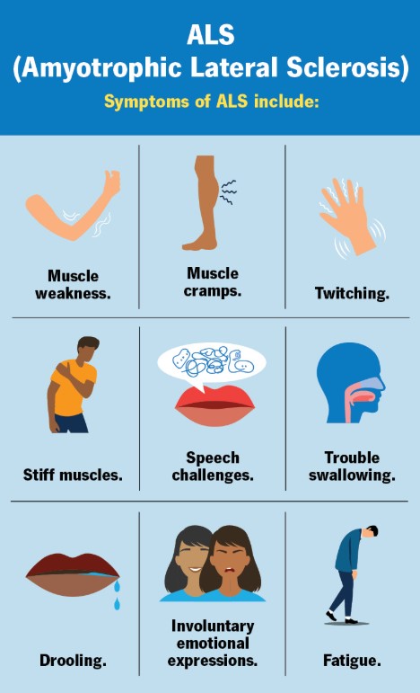 8017 - Amyotrophic lateral sclerosis | Medical EPSS