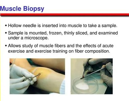 5314 - Group XIV | MEPSS | Medical EPSS