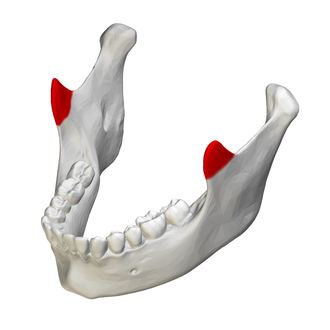 9909 - Coronoid process, loss of | Medical EPSS